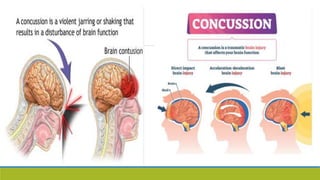 CRANIO – CEREBRAL INJURIES.pptx