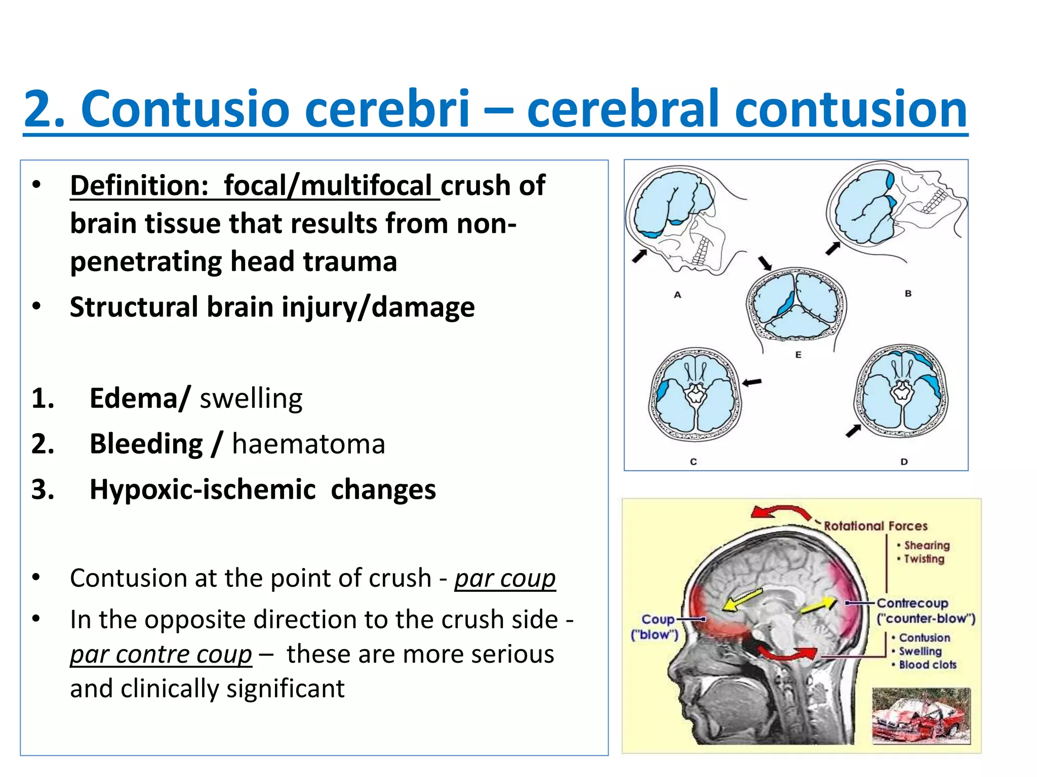 Craniocerebral Injury.ppt