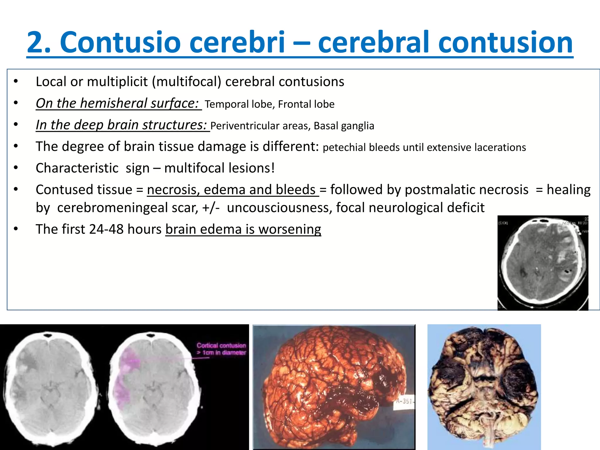 Craniocerebral Injury.ppt