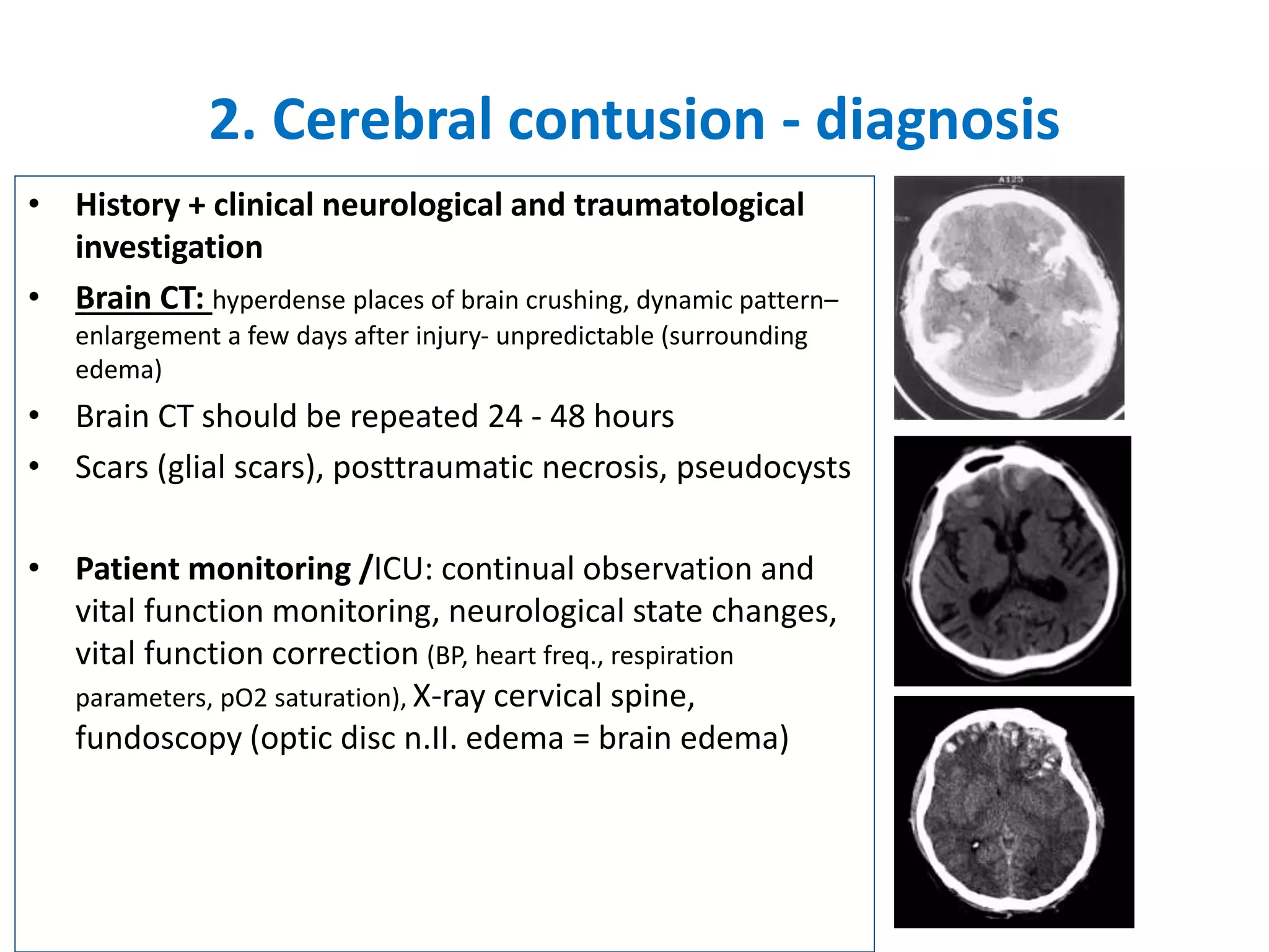Craniocerebral Injury.ppt
