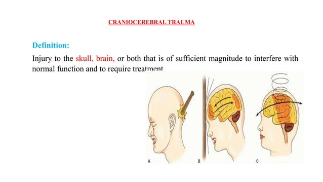 CRANIOCEREBRAL TRAUMA.pptx k,lkll346867987600789- | PPTX