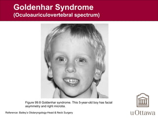 Craniofacial anomalies | PPT