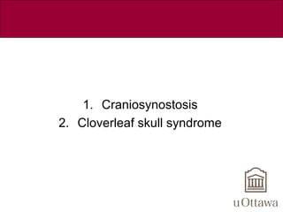 Craniofacial anomalies | PPT