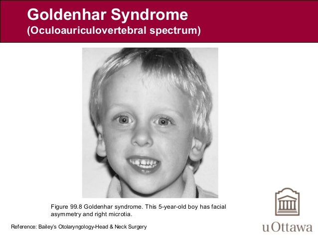 Craniofacial anomalies