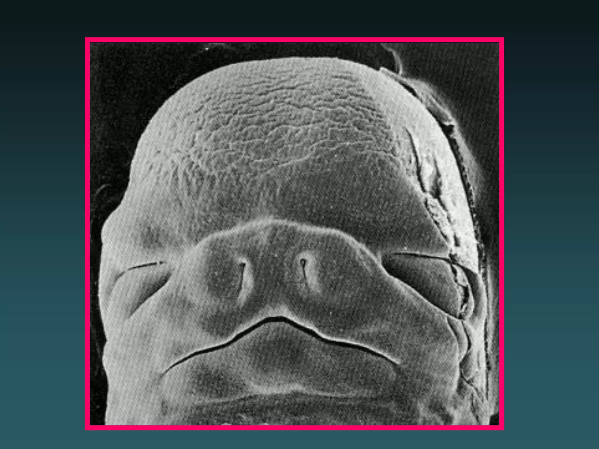 Craniofacial embryology Implications for craniofacial syndromes - July ...