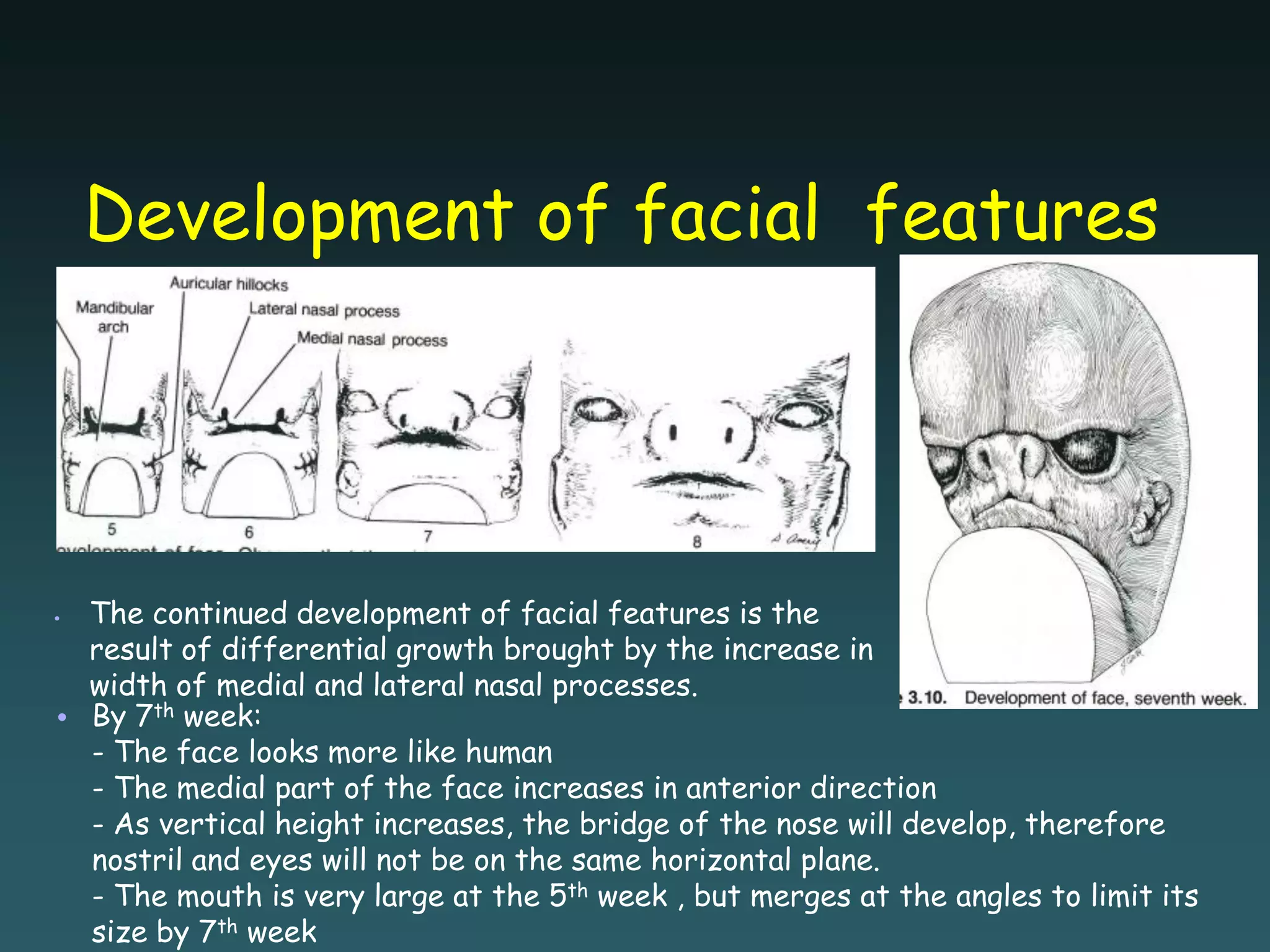 Craniofacial embryology Implications for craniofacial syndromes - July ...