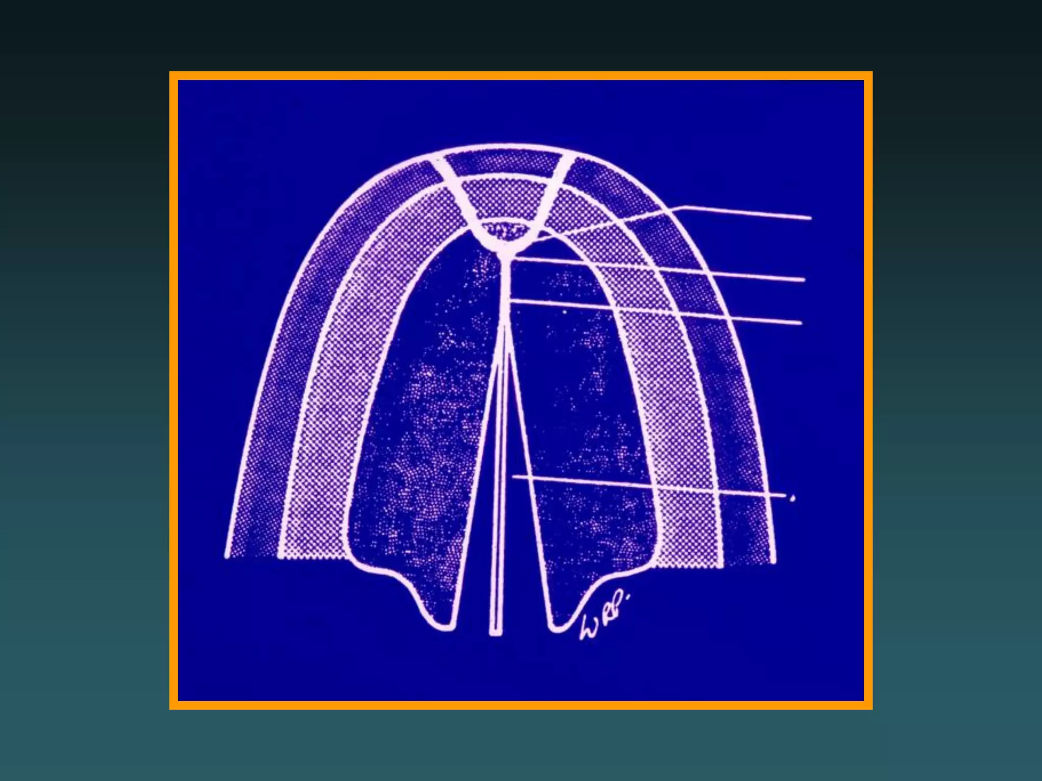 Craniofacial embryology Implications for craniofacial syndromes - July ...