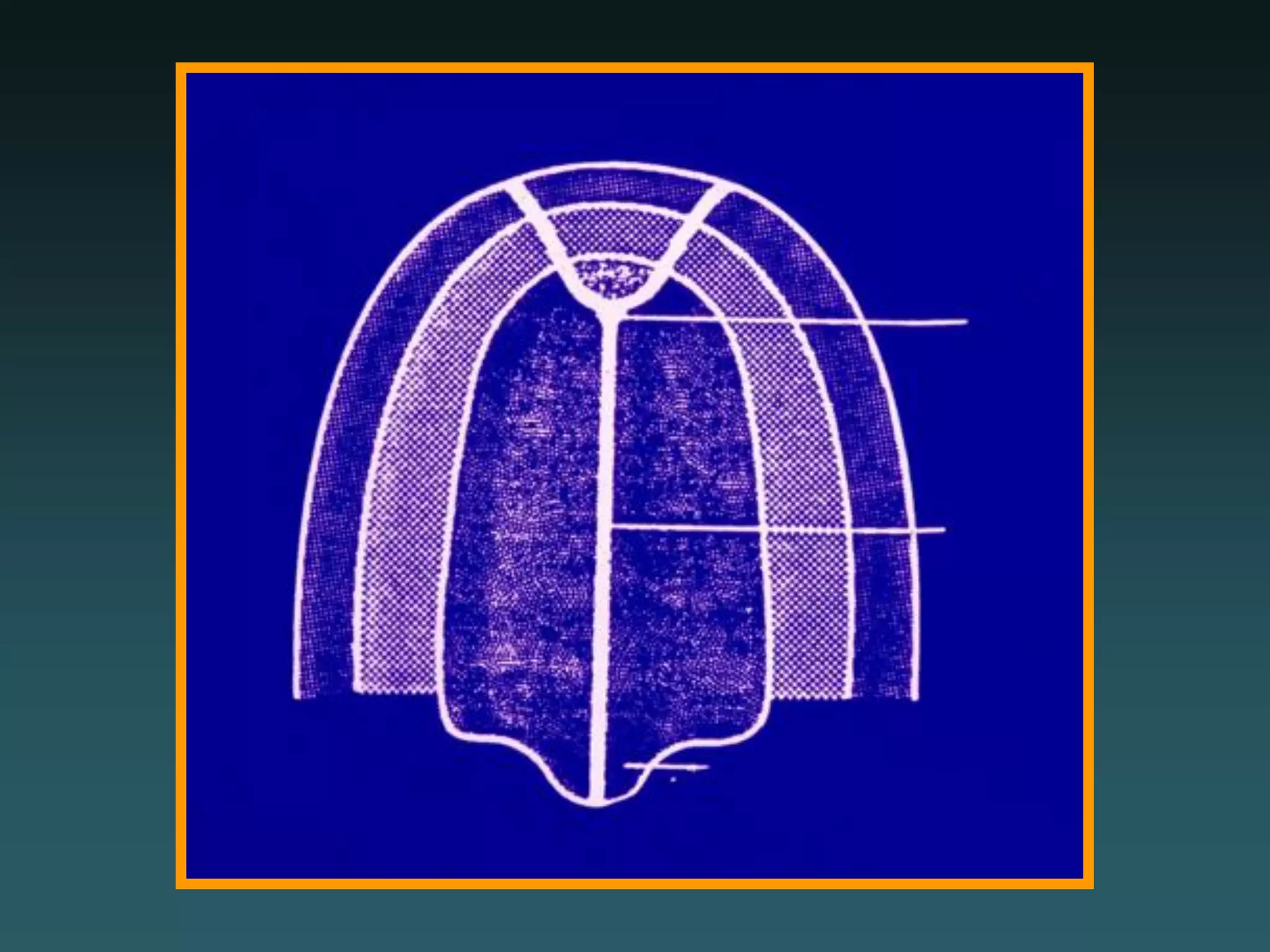 Craniofacial embryology Implications for craniofacial syndromes - July ...