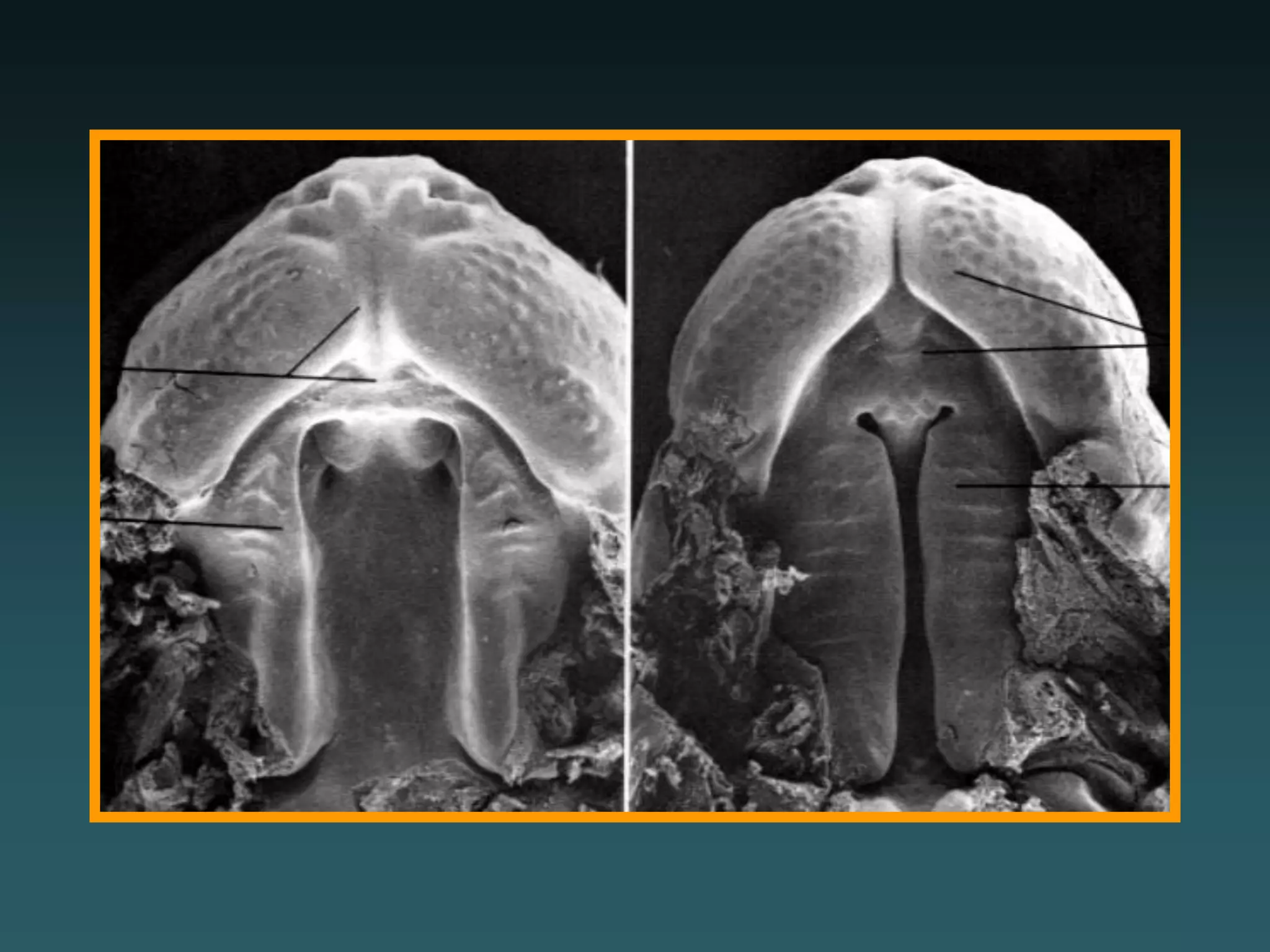 Craniofacial embryology Implications for craniofacial syndromes - July ...