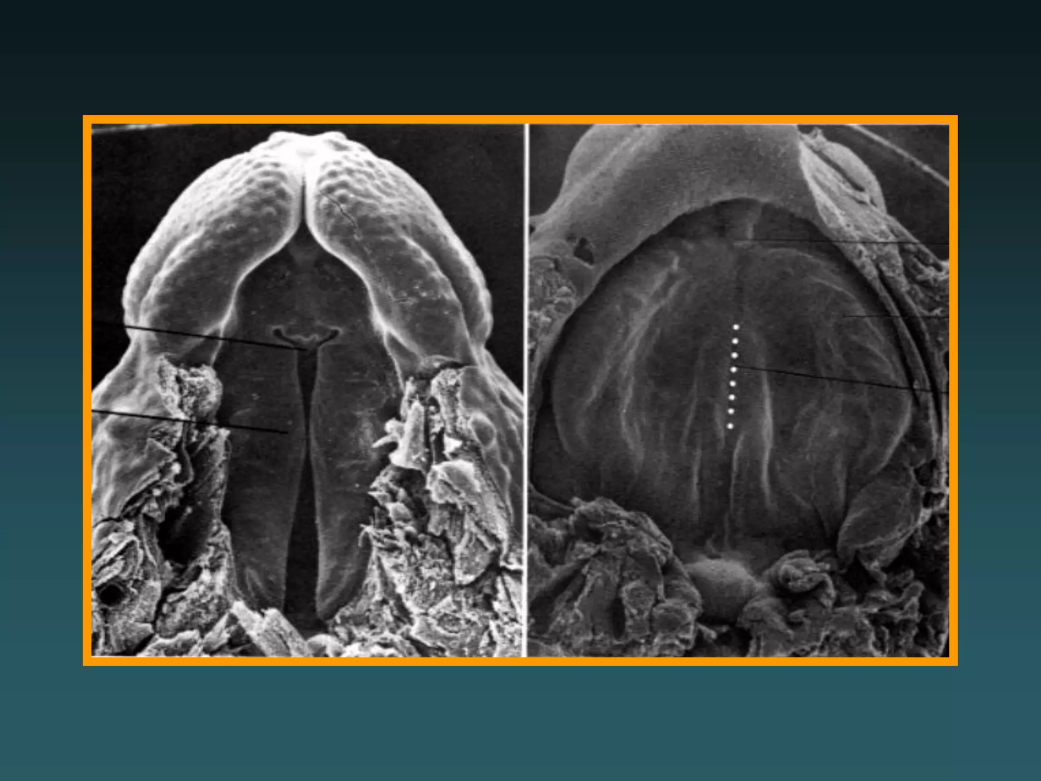 Craniofacial embryology Implications for craniofacial syndromes - July ...