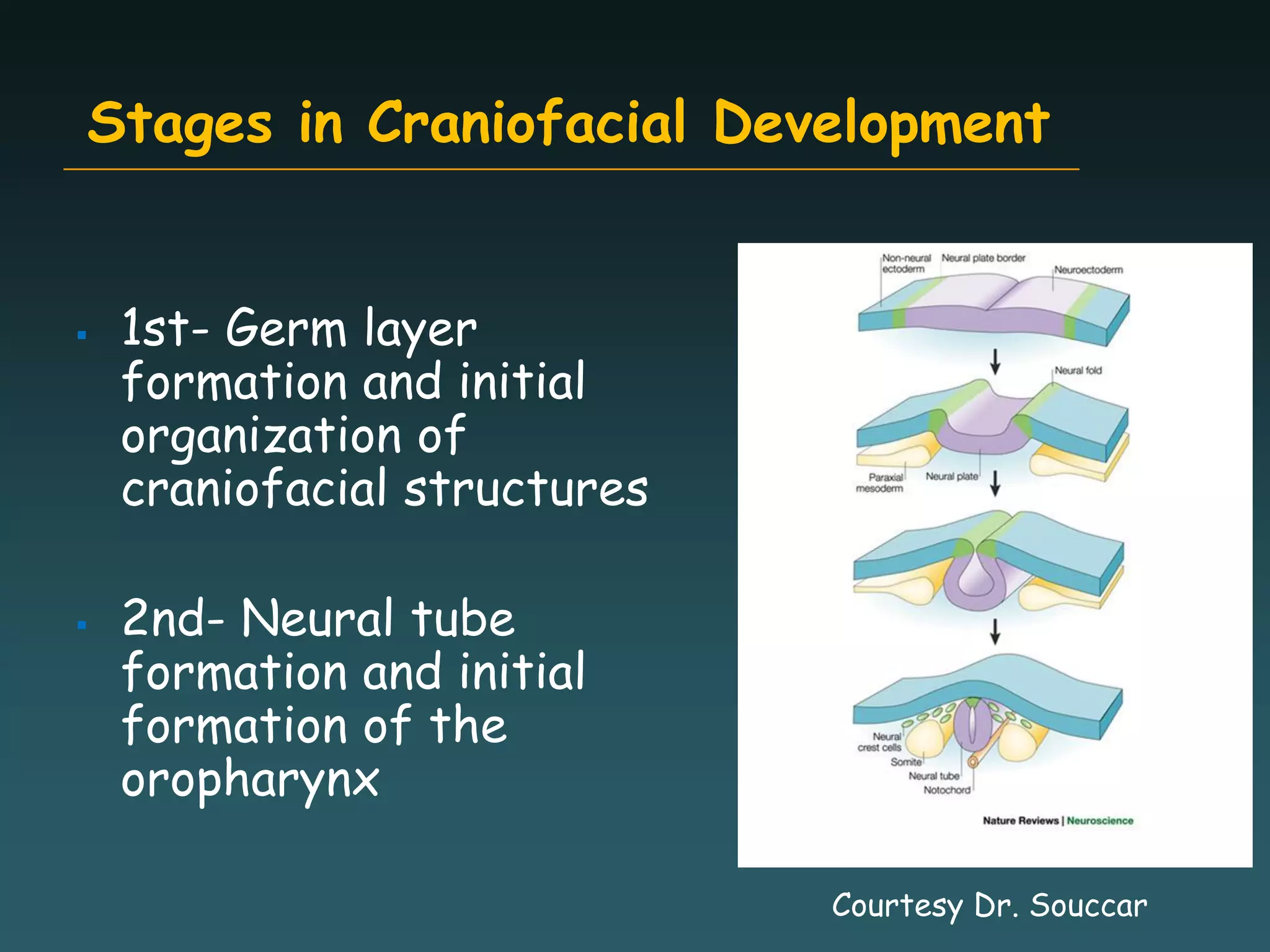 Craniofacial embryology Implications for craniofacial syndromes - July ...