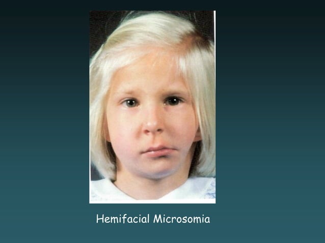 Craniofacial embryology Implications for craniofacial syndromes - July ...