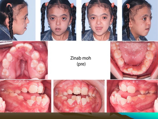 Craniofacial Growth and development 2020.pdf