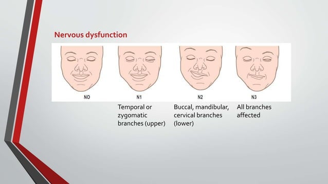 Craniofacial Microsomia | PPTX | Ear, Nose and Throat Conditions ...