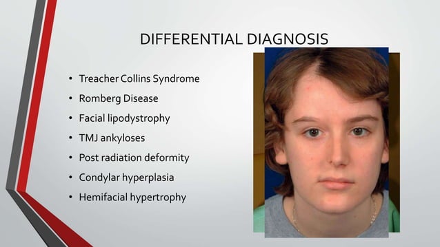 Craniofacial Microsomia | PPTX | Ear, Nose and Throat Conditions ...