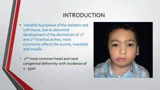 Craniofacial Microsomia | PPTX