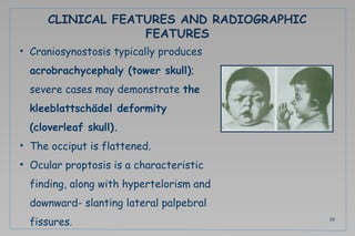 Craniofacial syndromes in orthodontics and the affect in the ortho ...