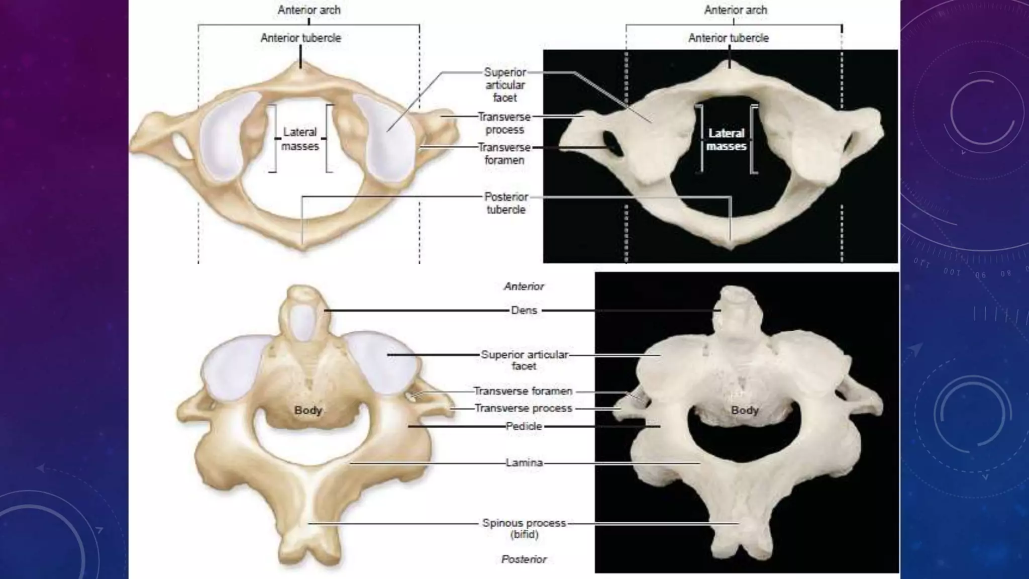 Craniometric lines | PPTX