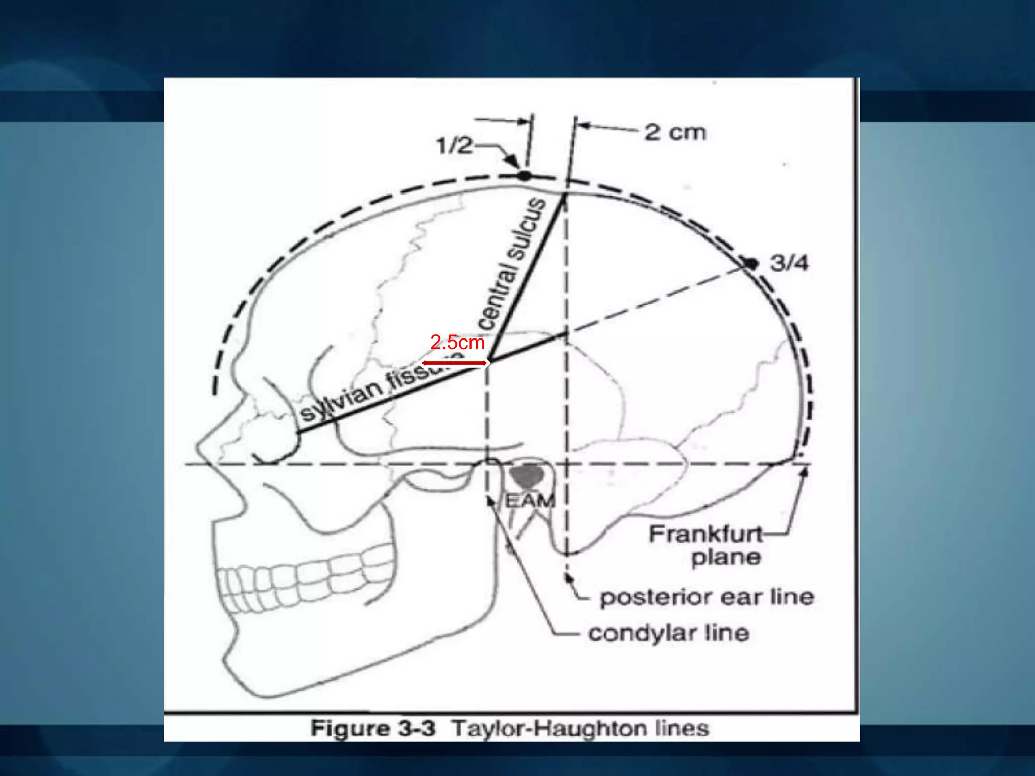 Craniometric points | PPTX