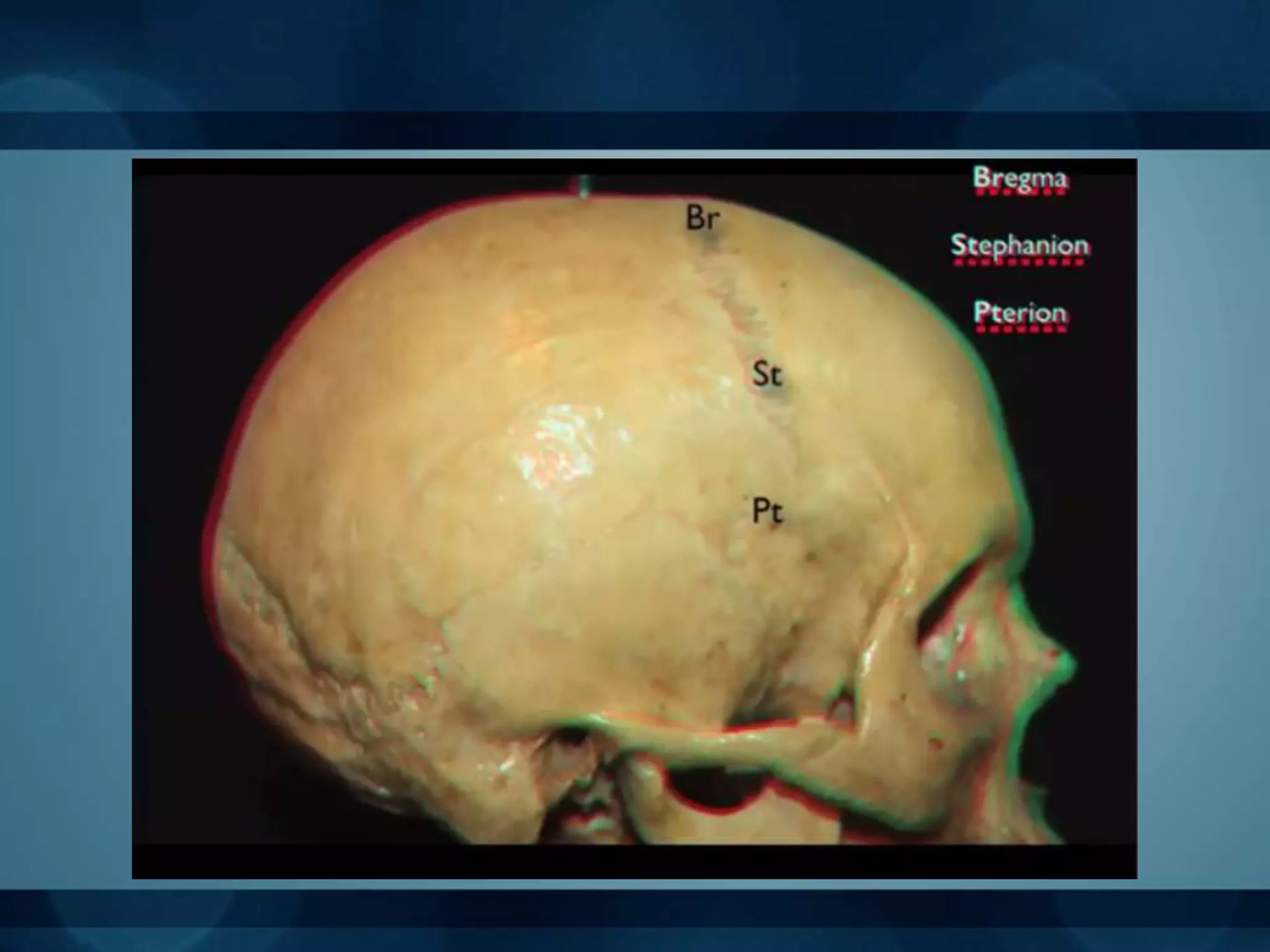 Craniometric points | PPTX