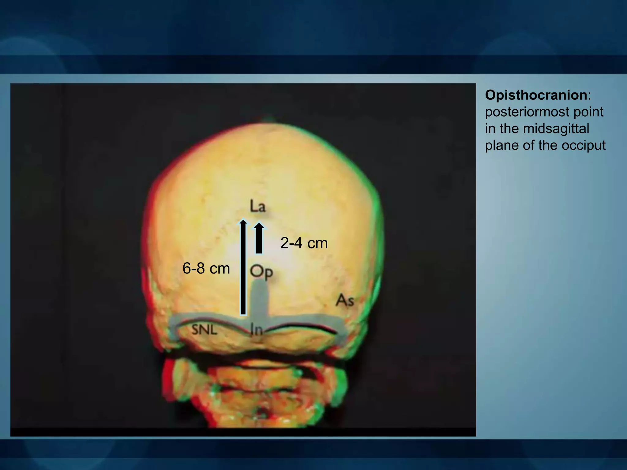 Craniometric points | PPTX