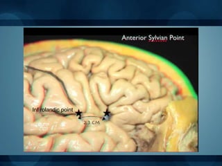Craniometric points | PPTX