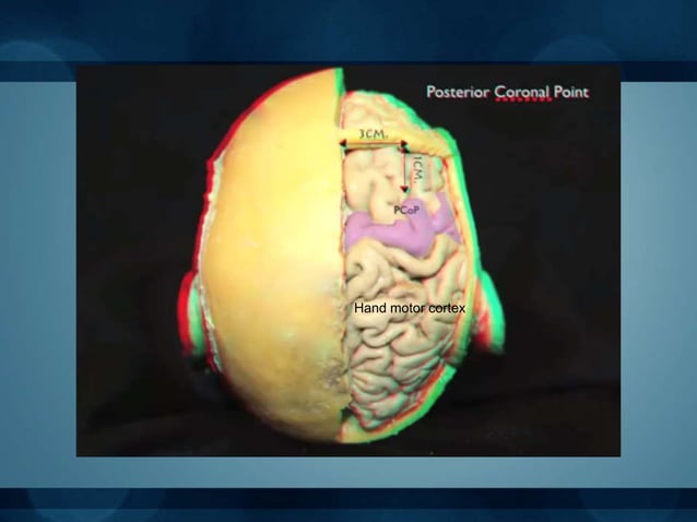 Craniometric points | PPTX