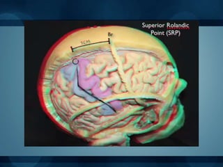 Craniometric points | PPTX