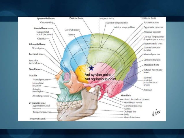 Craniometric points