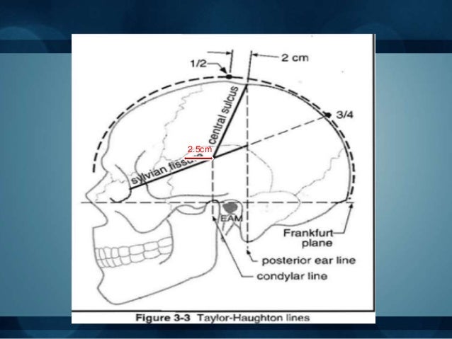 Craniometric points