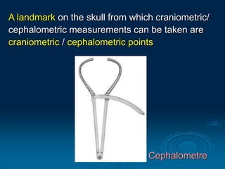 Craniometry.ppt