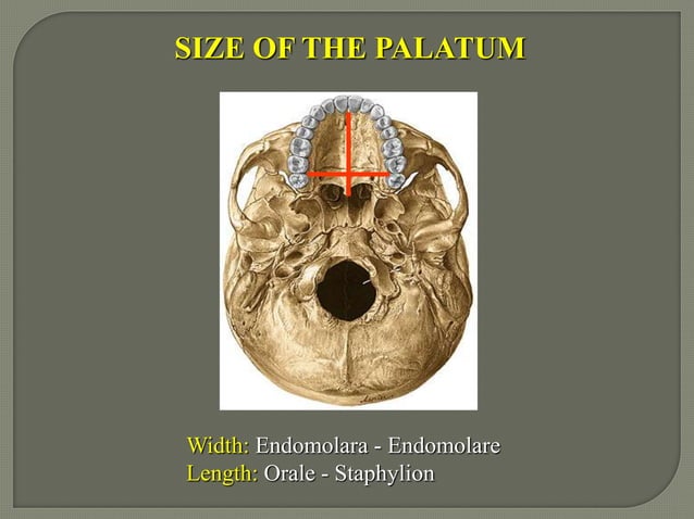 Craniometry.pptx | Bone and Joint Conditions | Diseases and Conditions