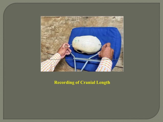 Craniometry.pptx | Bone and Joint Conditions | Diseases and Conditions