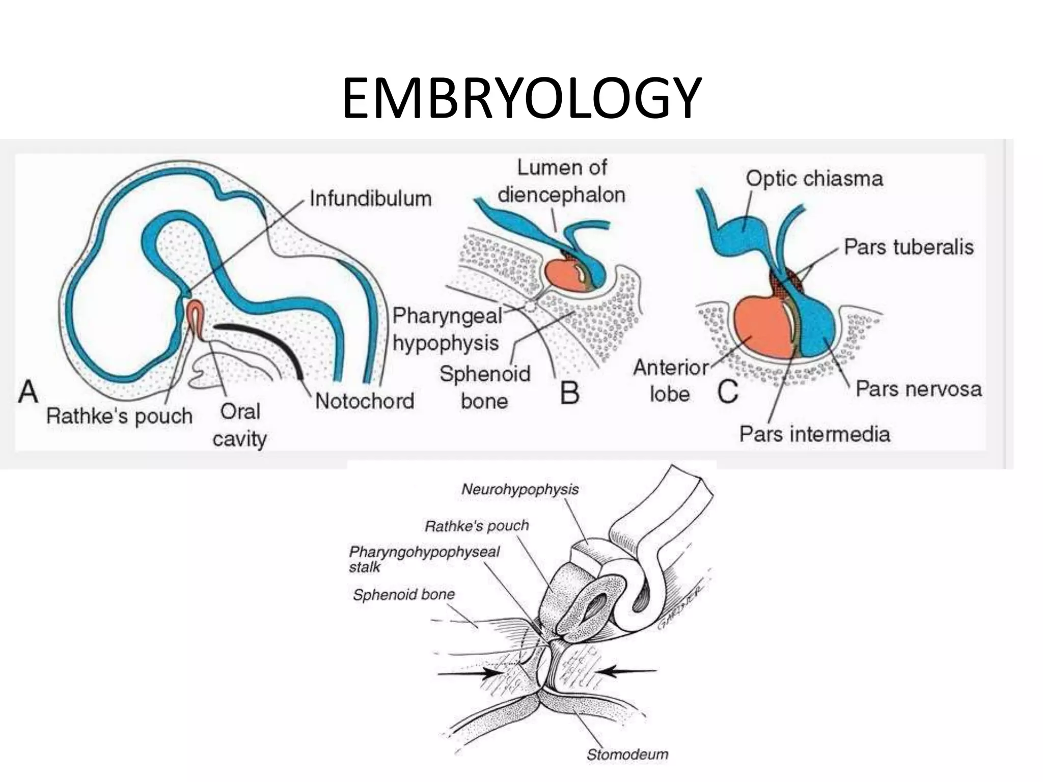 Craniopharyngioma | PPTX