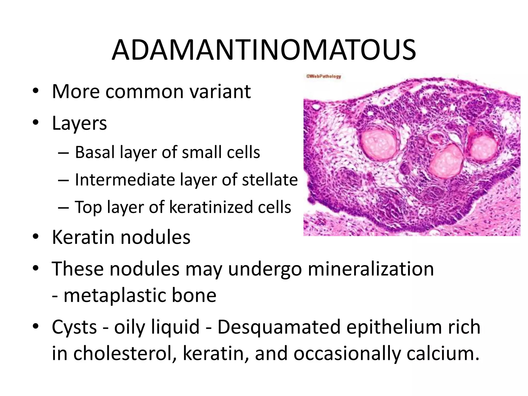 Craniopharyngioma | PPTX