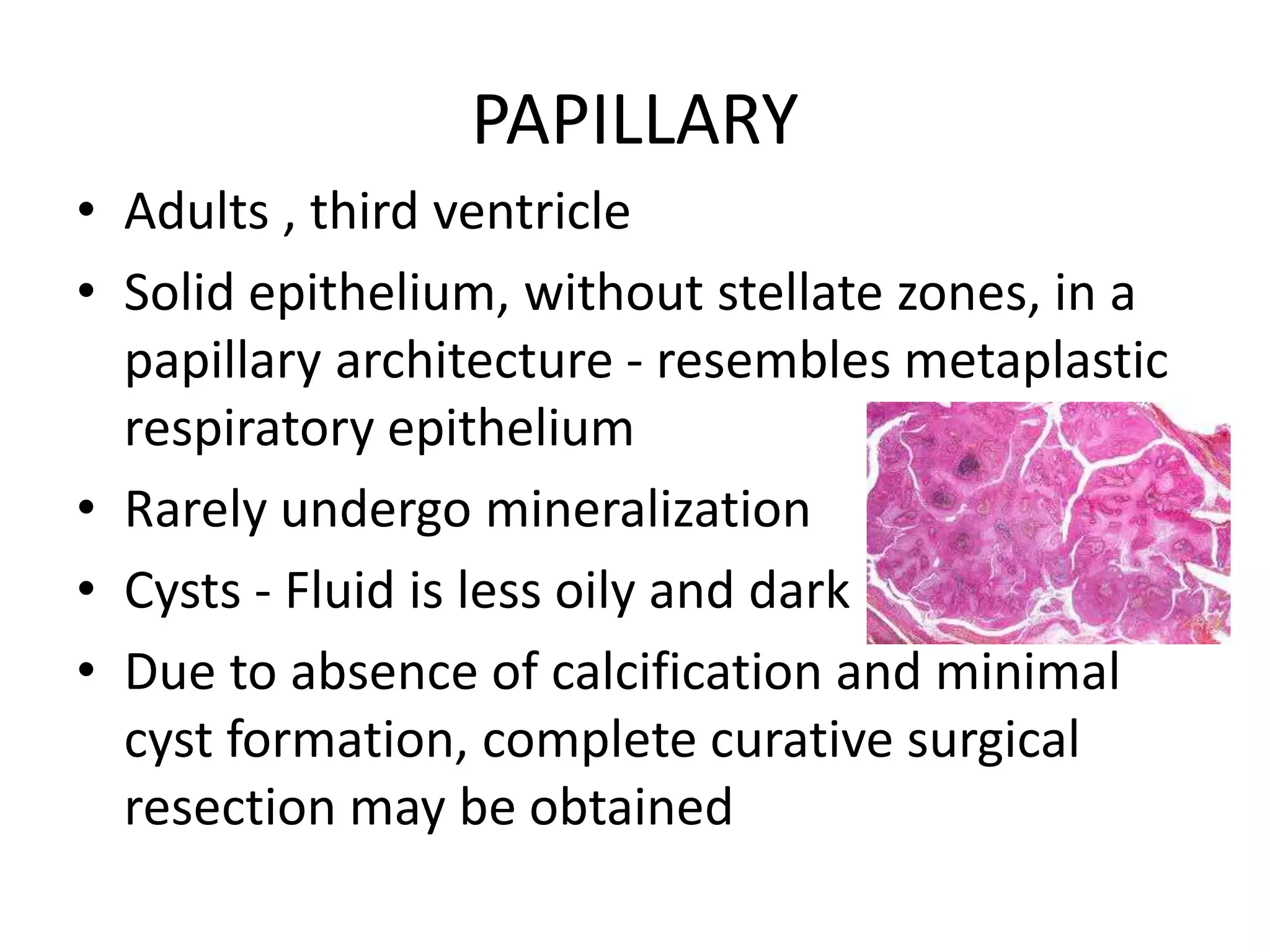 Craniopharyngioma | PPTX