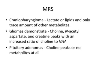 Craniopharyngioma | PPTX
