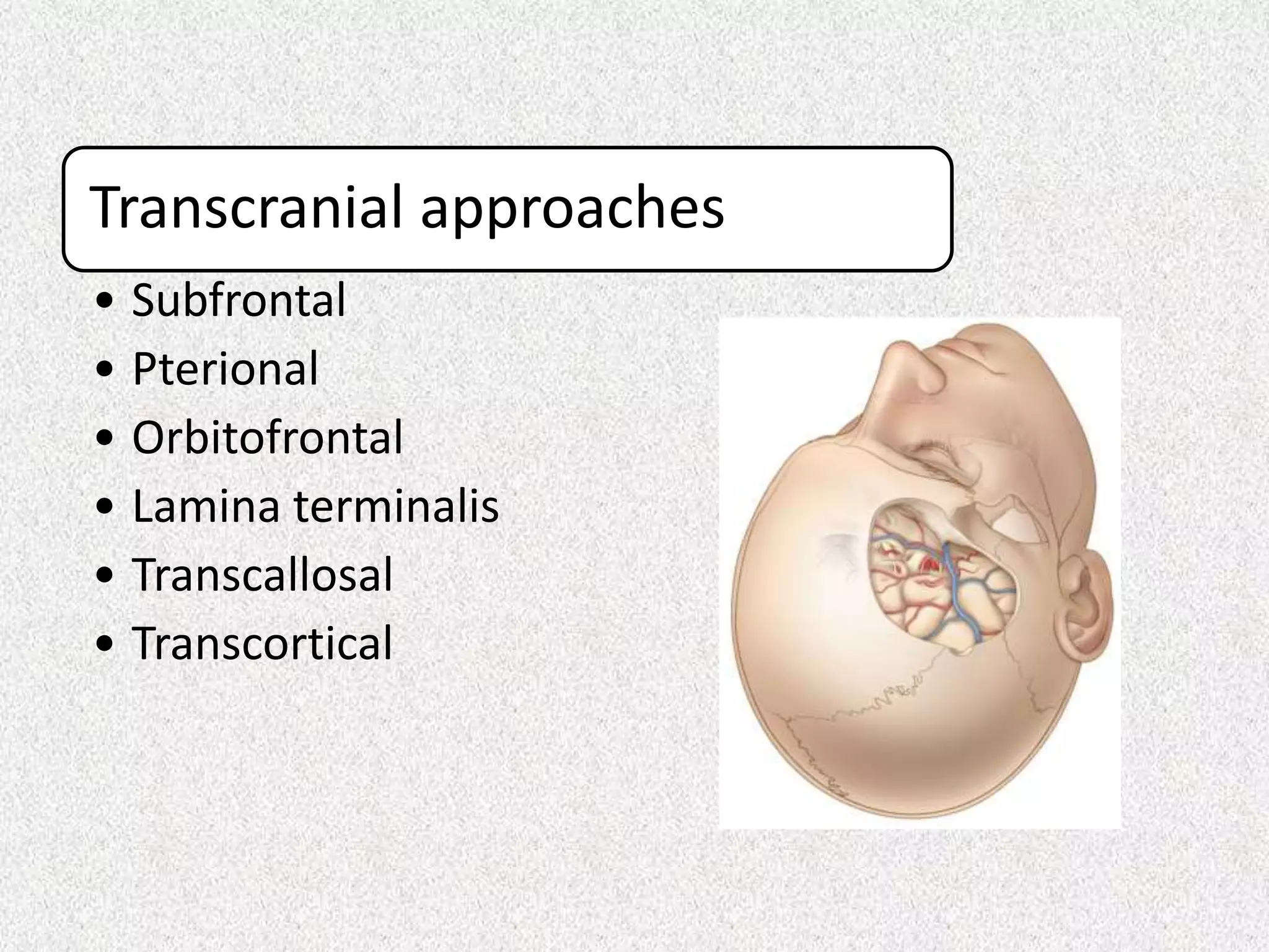 Craniopharyngioma | PPTX