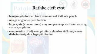 craniopharyngioma who grade 1 slide show.pdf