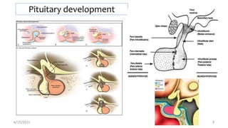 Craniopharyngiomas | PPTX