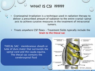 Craniospinal irradiation | PPTX
