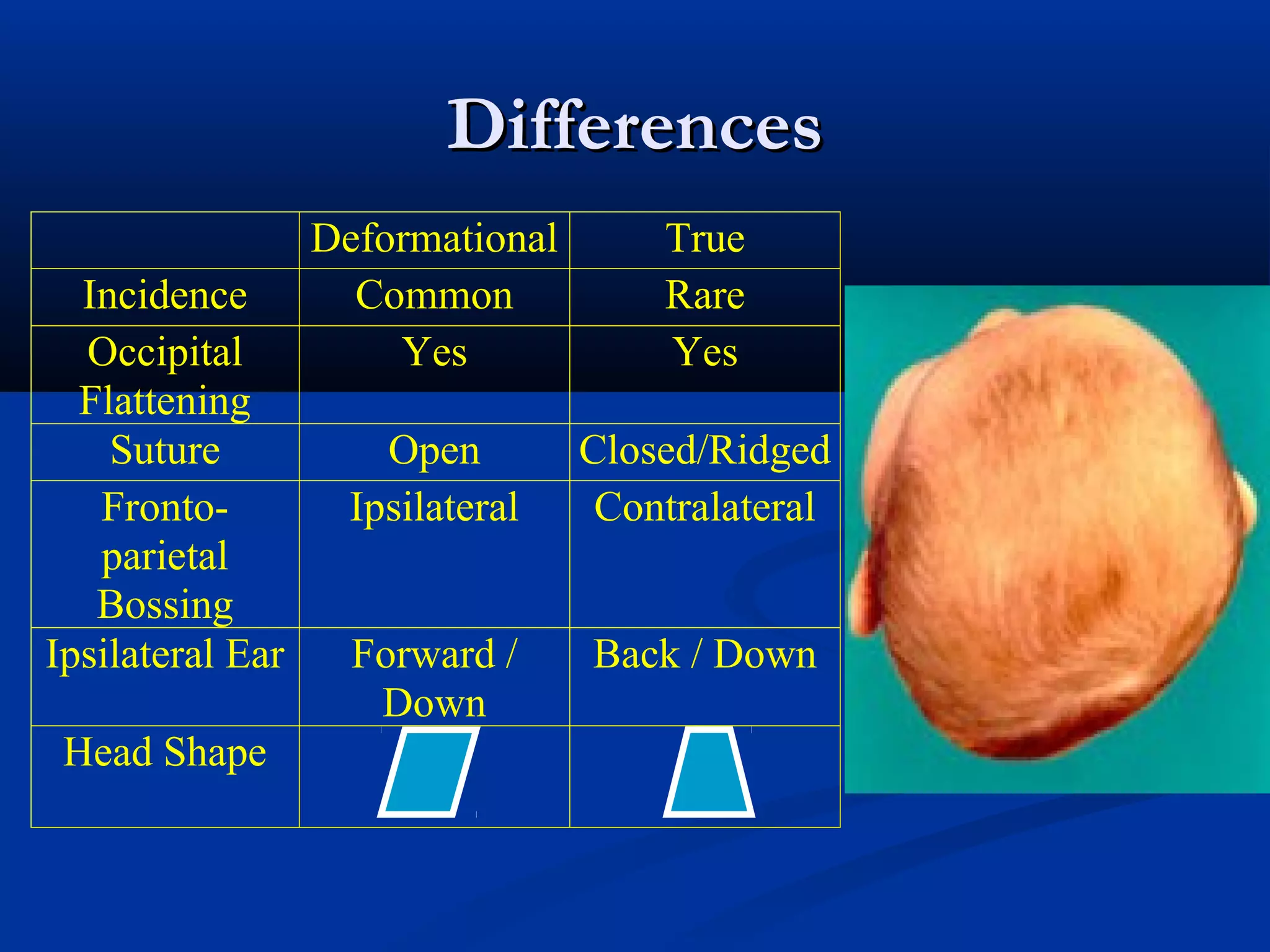 Craniostenosis | PPT