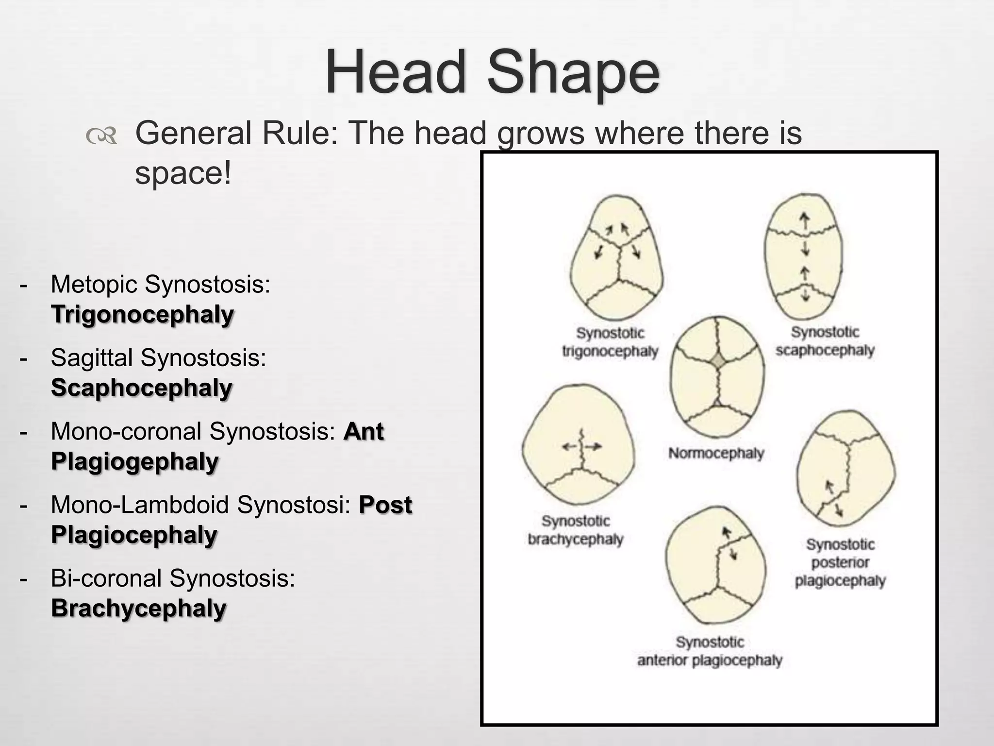 A Radiological Approach to Craniosynostosis | PPTX