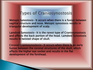 Craniosynostosis | PPTX