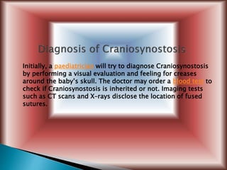 Craniosynostosis | PPTX