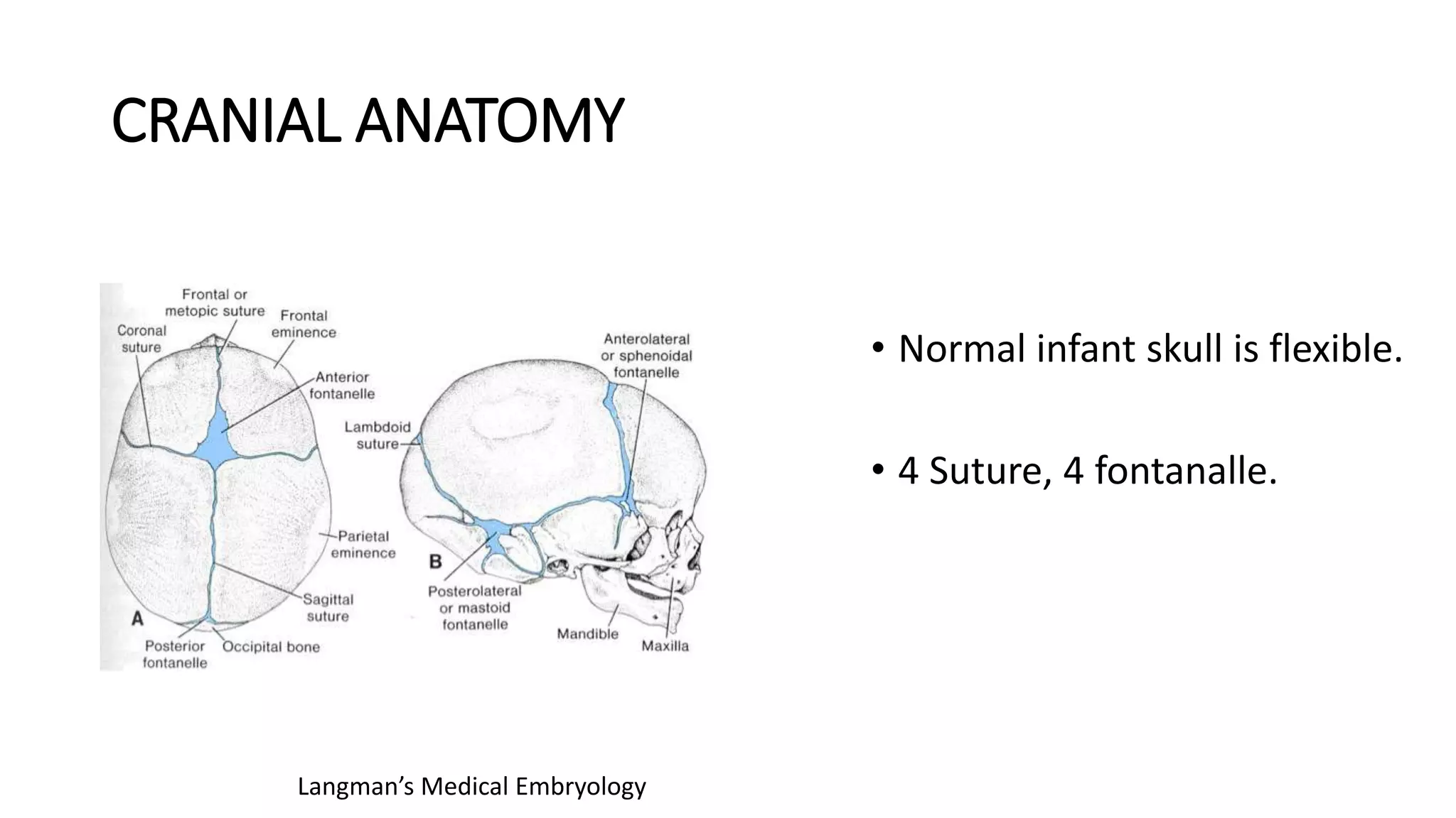 CRANIOSYNOSTOSIS CRANIO SYNOSTOSIS | PPTX