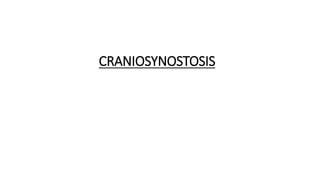 CRANIOSYNOSTOSIS CRANIO SYNOSTOSIS | PPTX