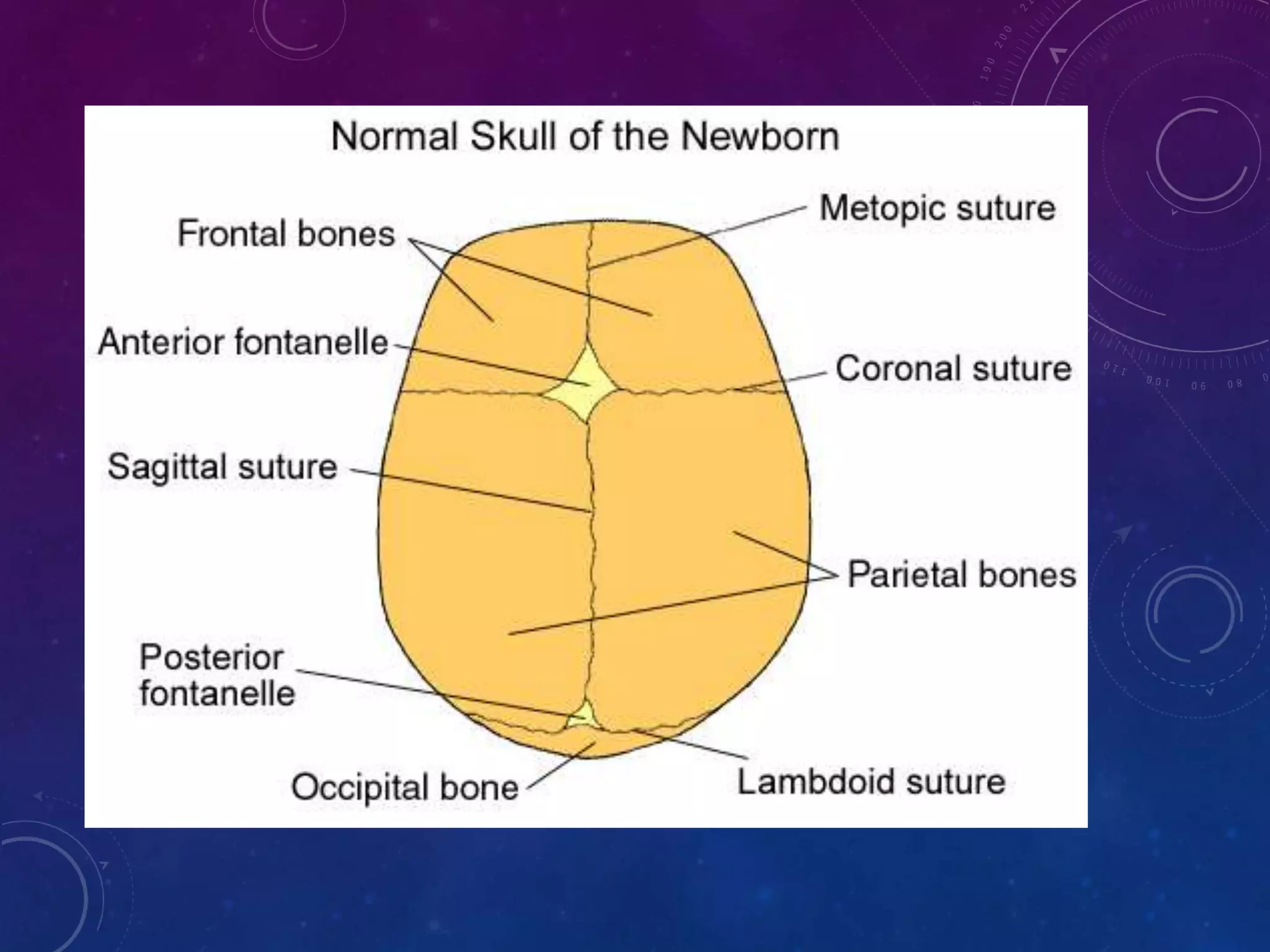 Craniosynostosis | PPTX
