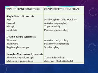 Craniosynostosis | PPTX
