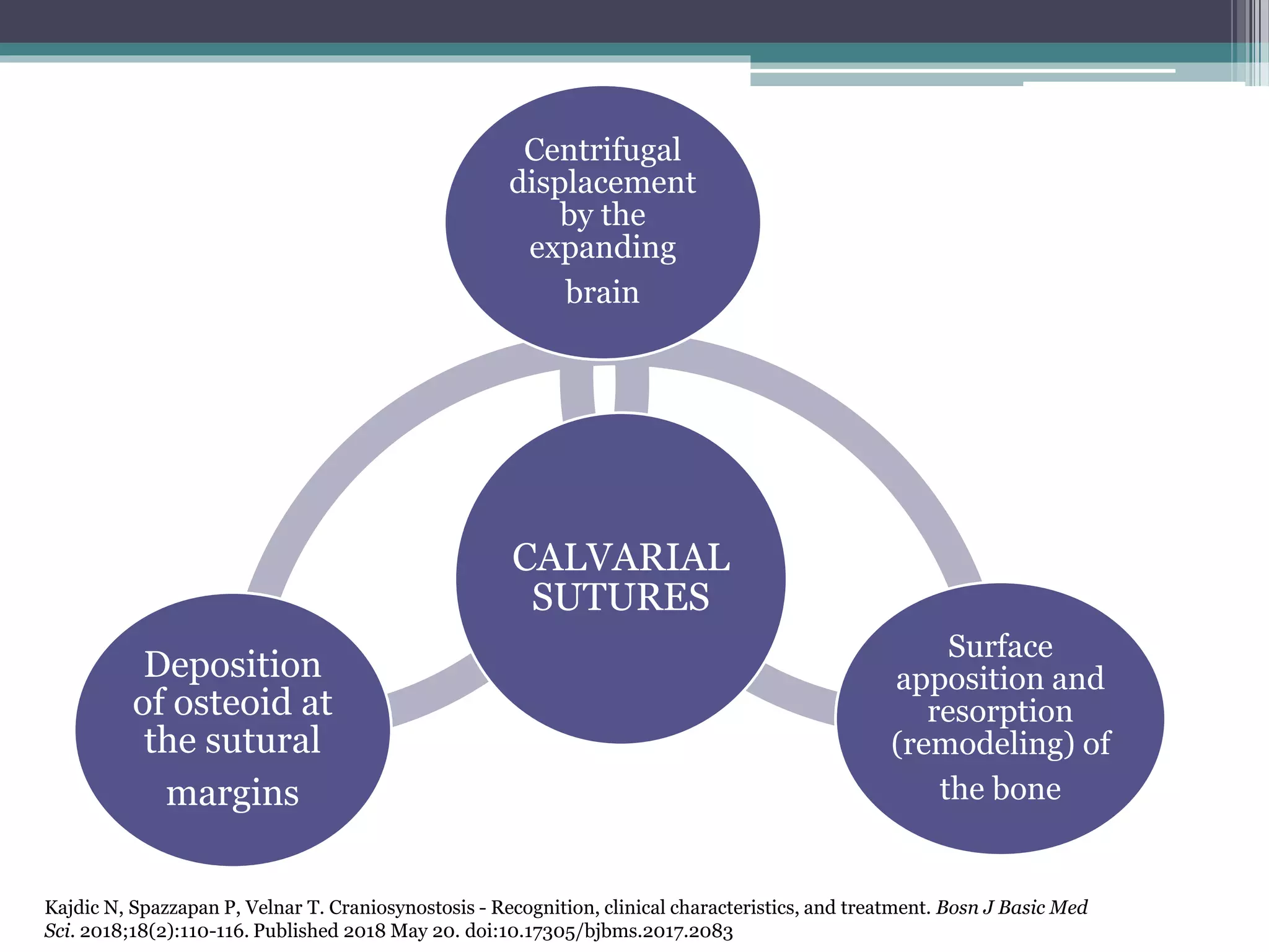 Craniosynostosis and strabismus | PPTX